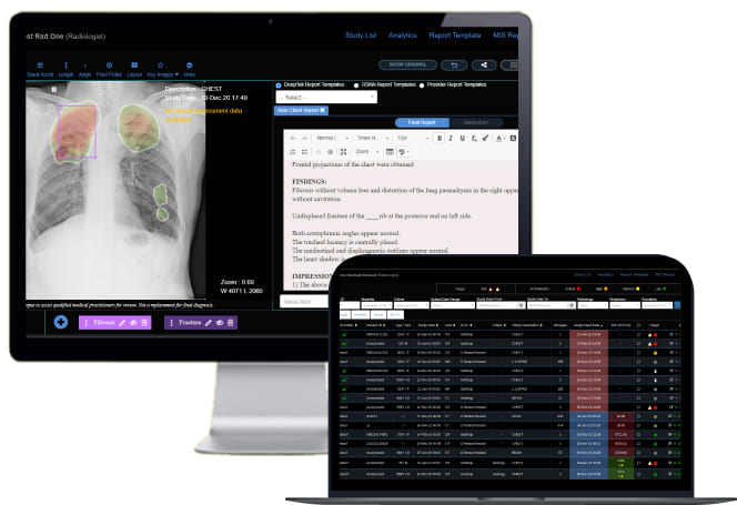 Deeptek Gateway Download & Installation Guide
